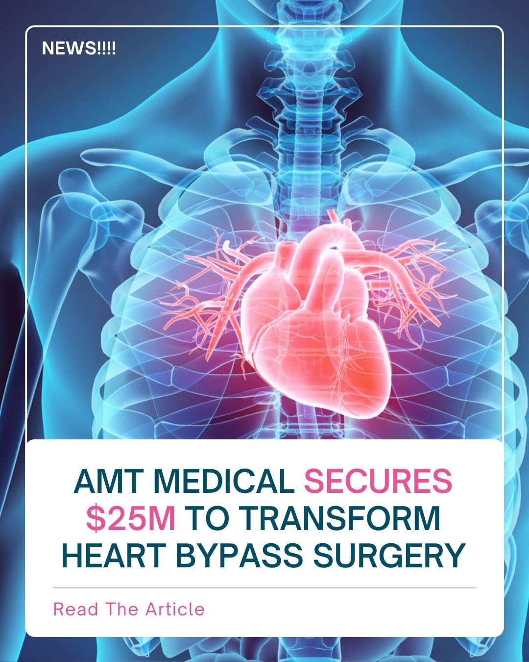 AMT Medical – The future of bypass surgery